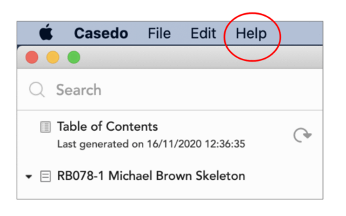 How do I find my License Key? | Support | Casedo